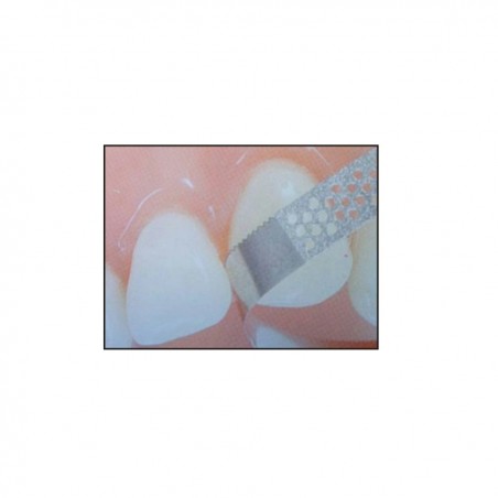Abrasive Polyester Strip Polishing and Finishing