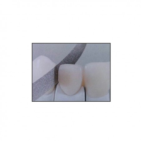 Abrasive Polyester Strip Polishing and Finishing