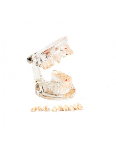 dental education model|dental models for patient education|dental ...