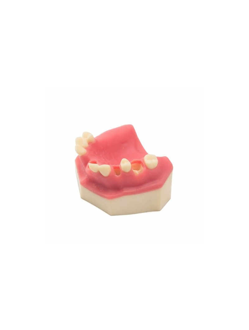 Teeth Study Model Of EASYINSMILE Lower Jaw Typodont Teeth Study Model ...