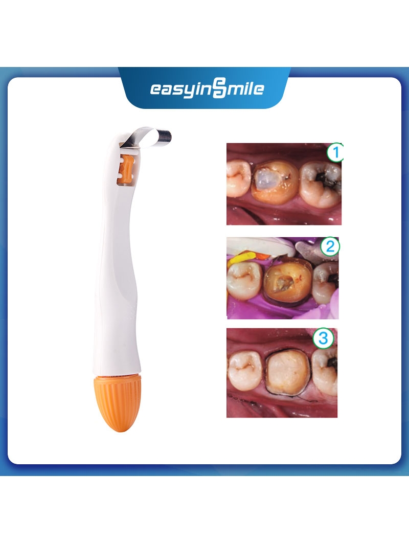 50Pcs/Box Dental Section Metal Matrix System Matrices With Tightening ...