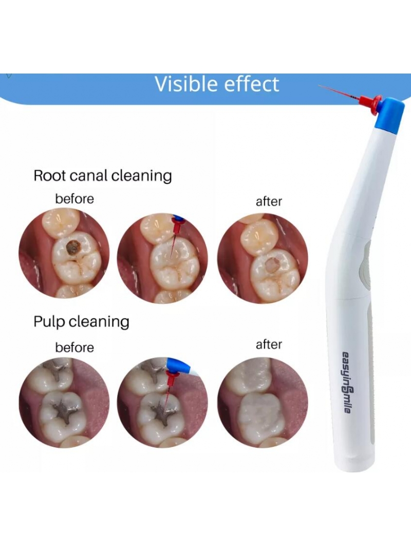 Dental Endodontic Ultrasonic Sonic Endo Irrigator Endo Activator Kit ...