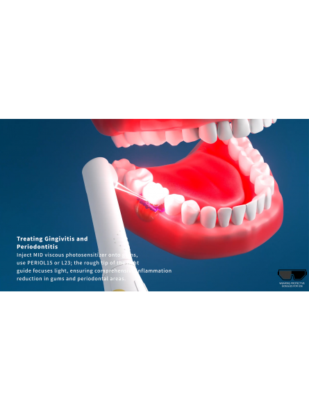 Easyinsmile New Dental Photodynamic Therapy Dentist Device For ...