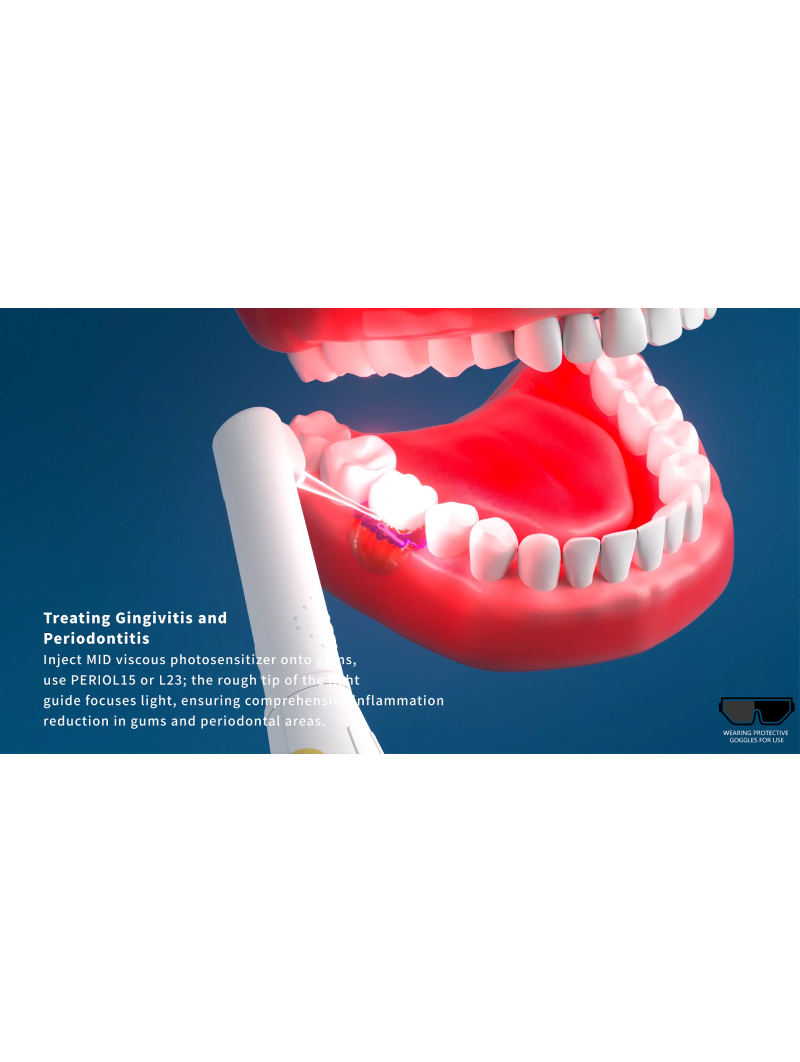 New Easyinsmile Dental Photodynamic Therapy Red Light Multi Treatment ...