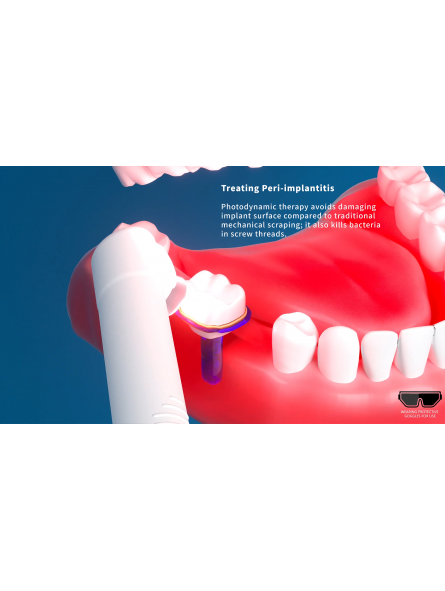 New Easyinsmile Dental Photodynamic Therapy Red Light Multi Treatment ...