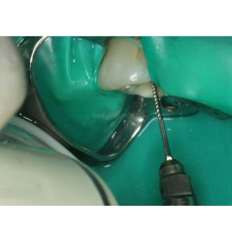 Dental Endodontic Ultrasonic Scaler Tip Files Endo Root Canal Cleaning ...