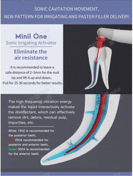 Easyinsmile Dental Endo Sonic Activator Mini Head Ultra Sonic 45Tips ...