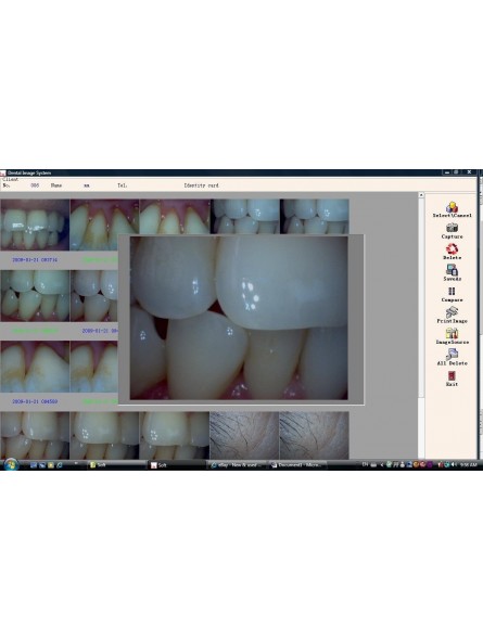 iris intraoral camera|dental camera|sopro intraoral camera|schick ...